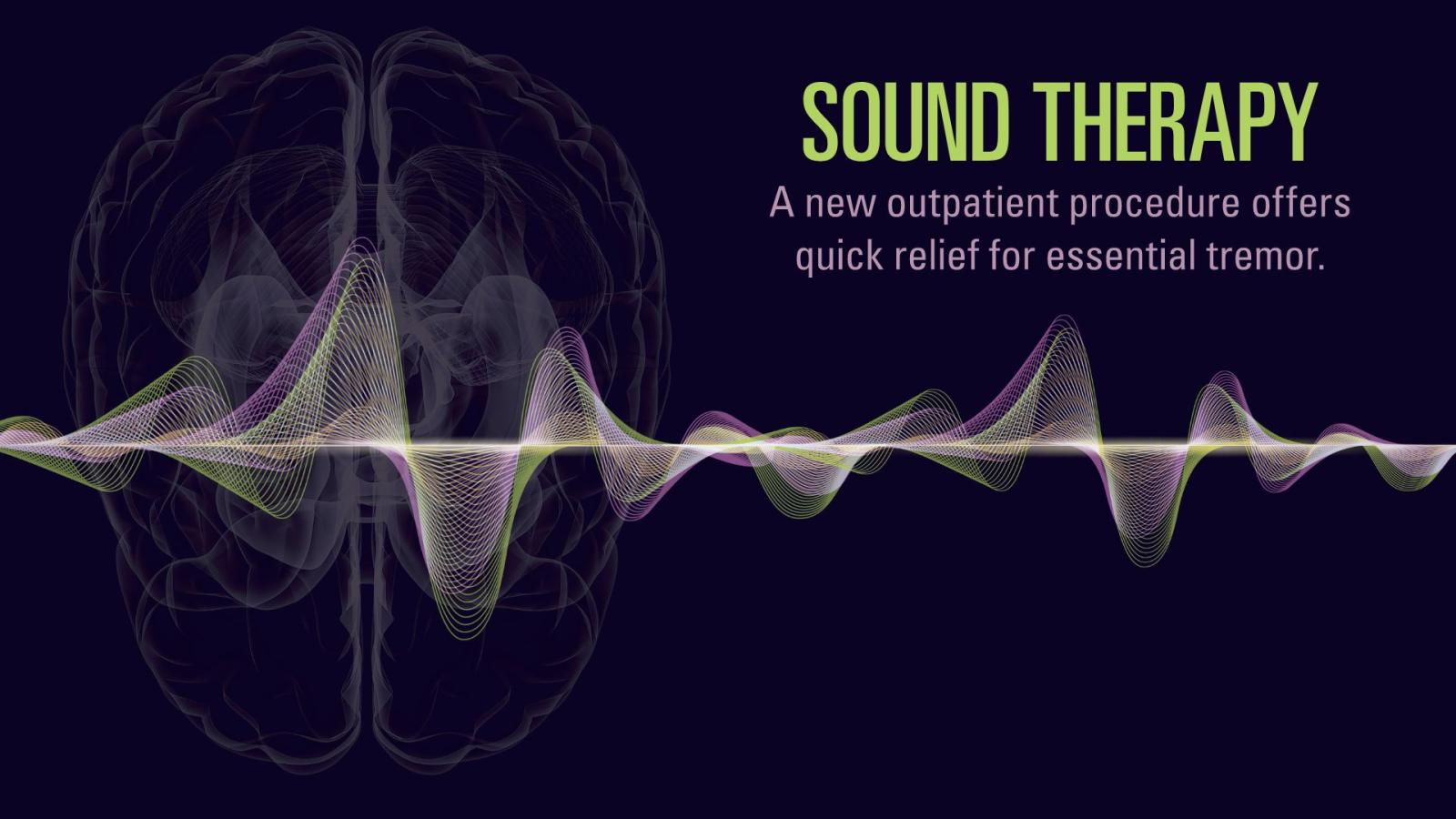 Sound Therapy: Using Focused Ultrasound for Essential Tremor | Medical College of Virginia ...